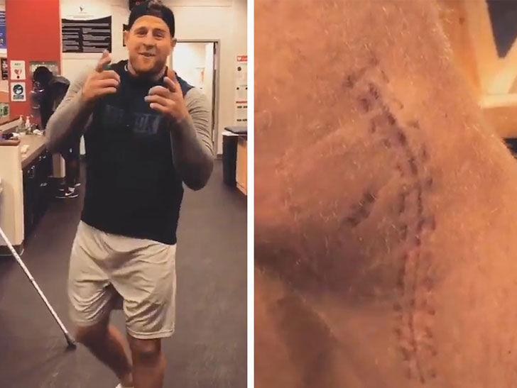 J.J. Watt Shows Off Gnarly Leg Surgery Scar | TMZ.com