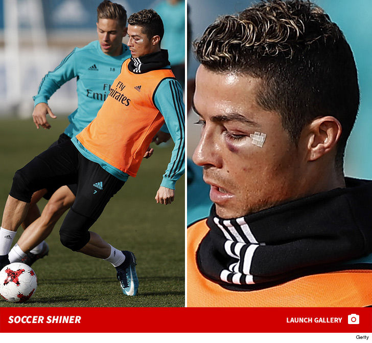 Cristiano Ronaldo Sports Black Eye After Bloody Collision | TMZ.com