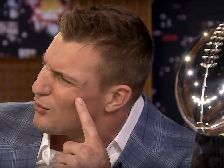 Rob Gronkowski Face