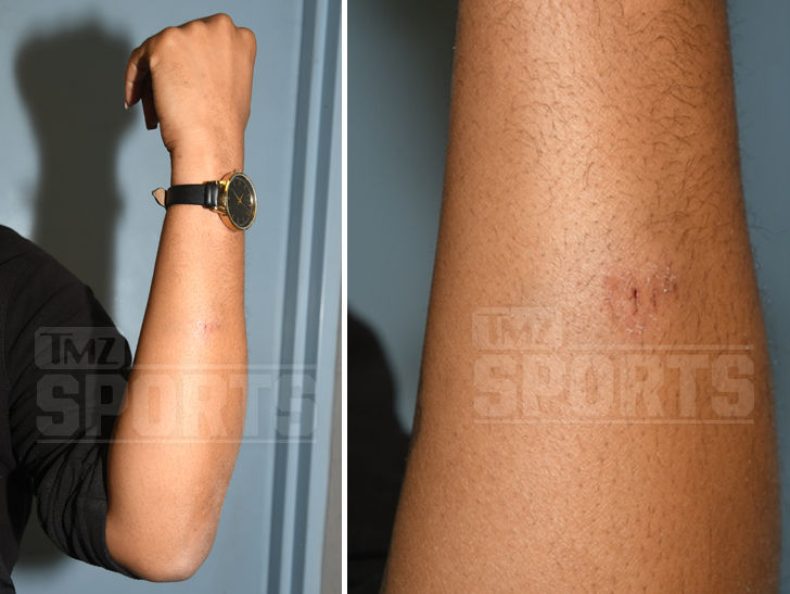 Antonio Brown Domestic Violence Case Pics Show Minor Scrape | TMZ.com